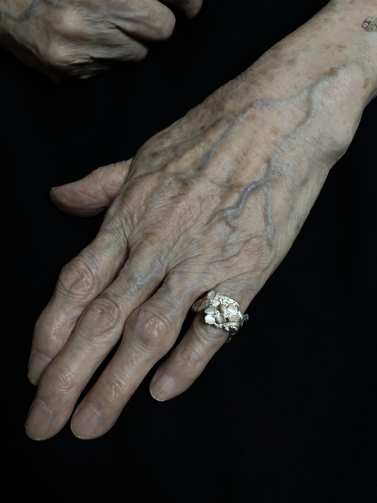 Everlasting Flowers ring(金木犀・#9) | yuka ishikawa