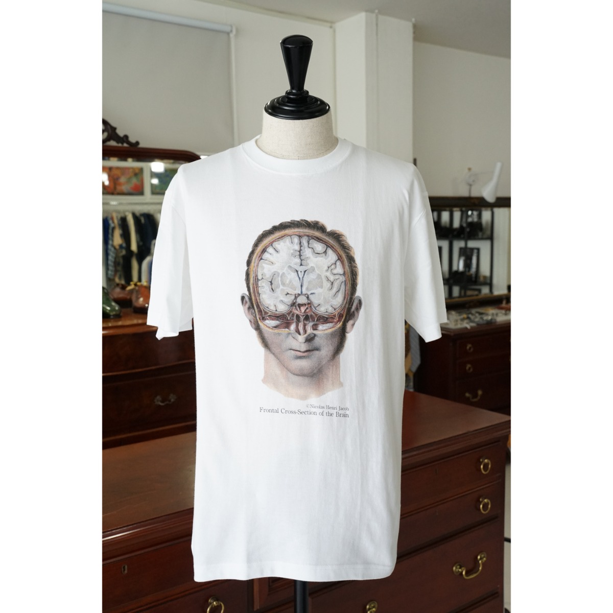 "Frontal Cross-Section of the Brain" | Pickle