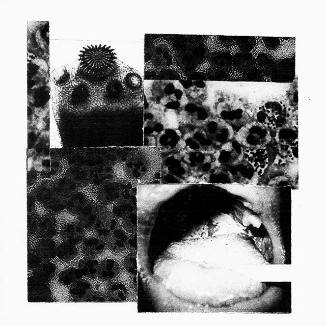 Hemorrhagic Pyrexia Virus / Gonococcus - split (7ep) | 死体カセット